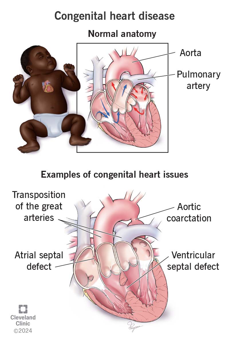 Unraveling Rare Fetal Heart Defects: Diagnosis, Treatment, and Research Insights | Prime ...